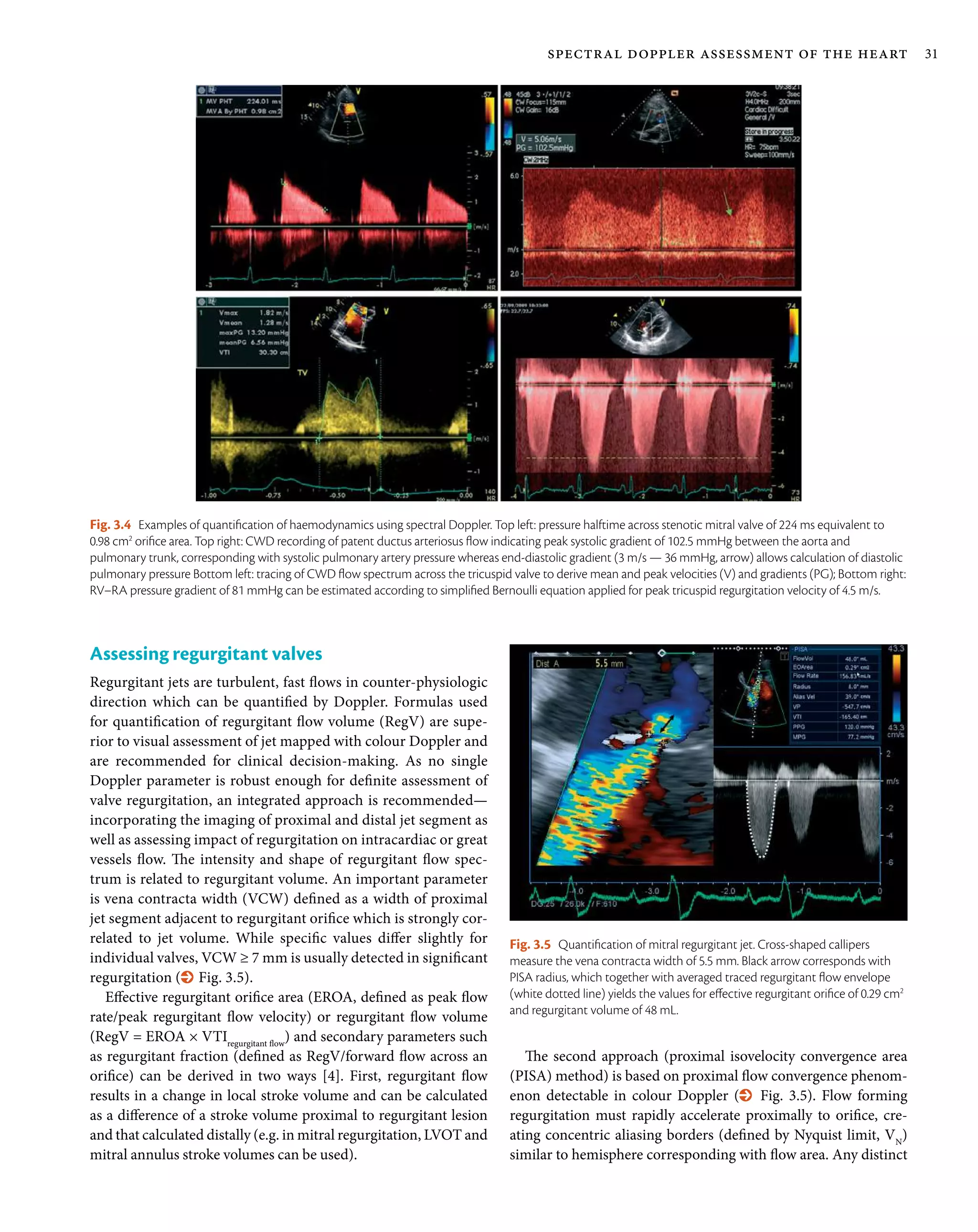 Doppler echocardiography | PDF | Heart and Cardiovascular Diseases | Diseases and Conditions