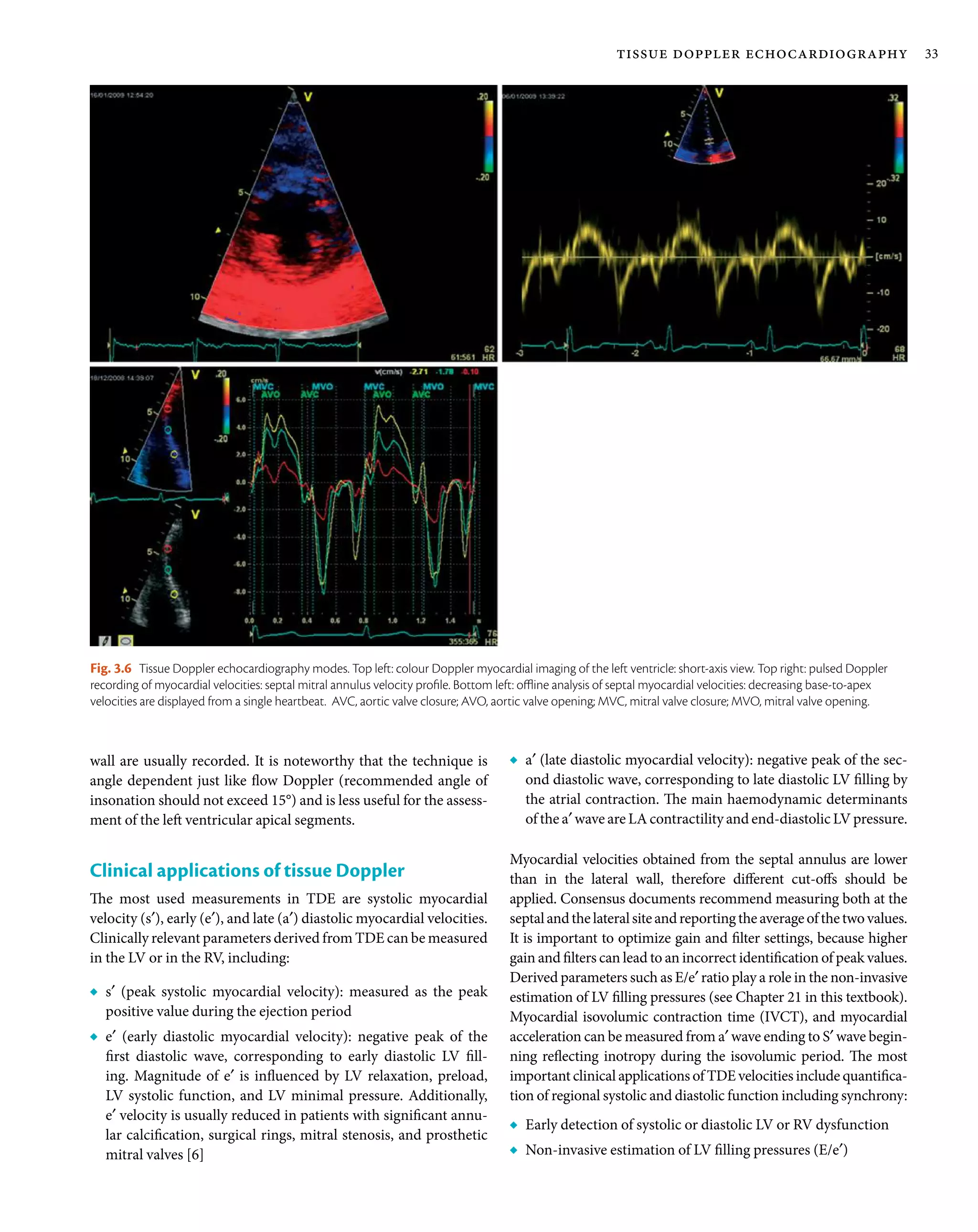 Doppler echocardiography | PDF | Heart and Cardiovascular Diseases | Diseases and Conditions