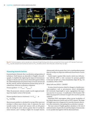 Doppler echocardiography | PDF | Heart and Cardiovascular Diseases ...