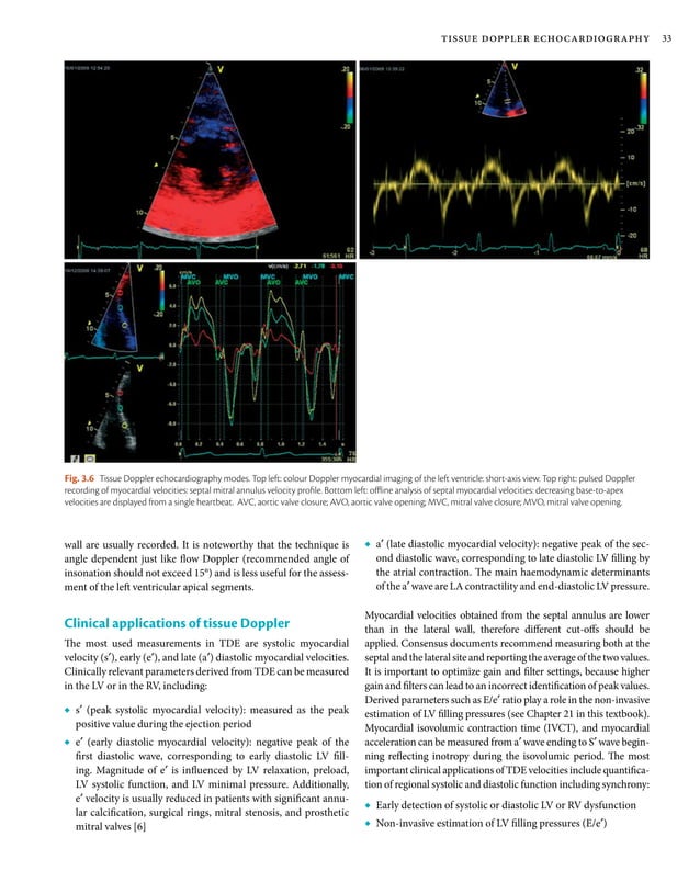 Doppler echocardiography | PDF