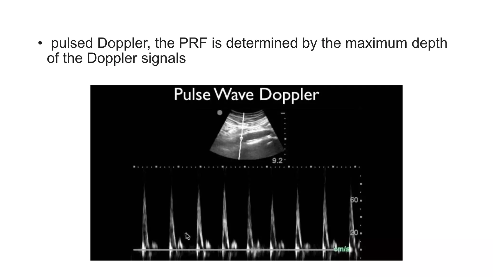 Doppler echocardiography | PPTX