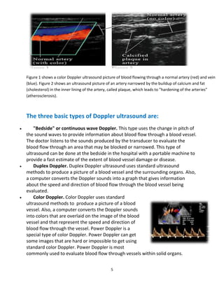 Doppler effect | DOCX | Digital Audio | Computer Software and Applications