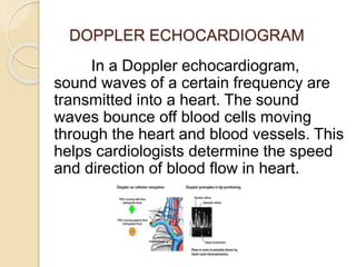 Doppler effect | PPTX