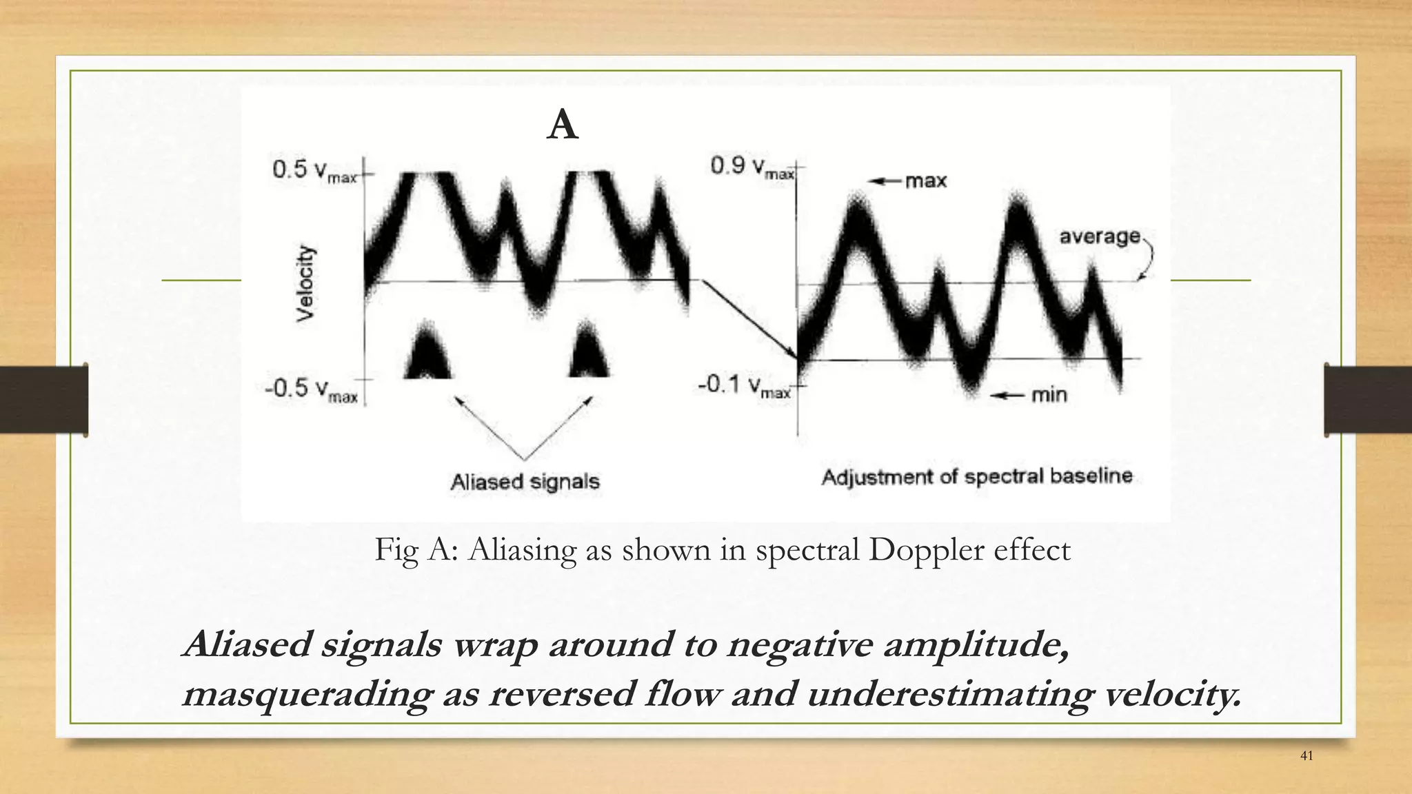 Doppler Effect - Ultrasound | PPTX | Digital Audio | Computer Software ...