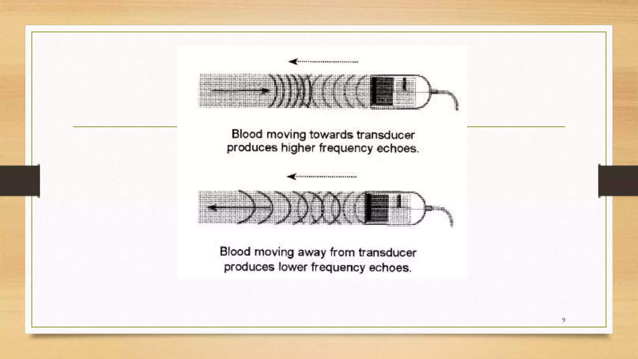 Doppler Effect - Ultrasound | PPTX | Digital Audio | Computer Software ...