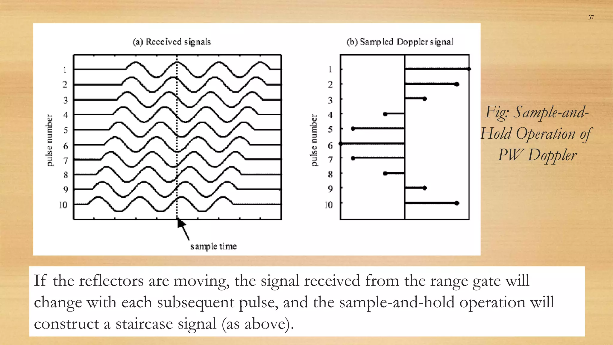 Doppler Effect - Ultrasound