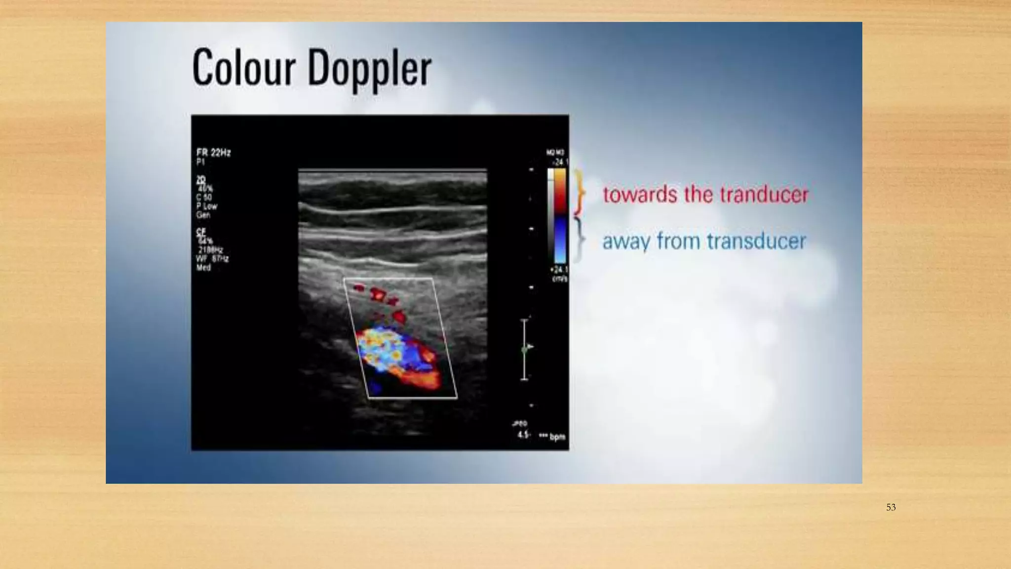 Doppler Effect - Ultrasound