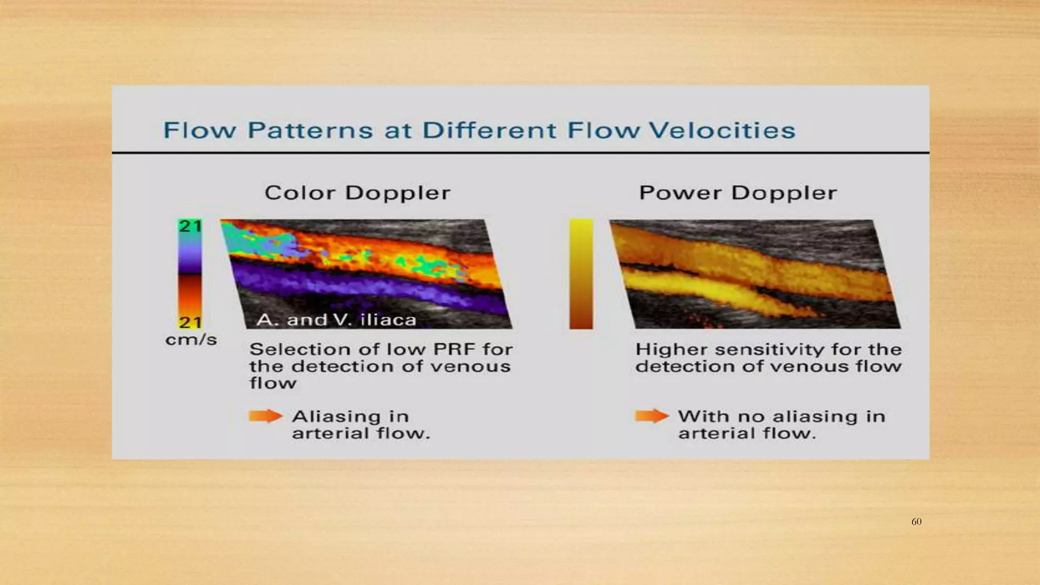 Doppler Effect - Ultrasound