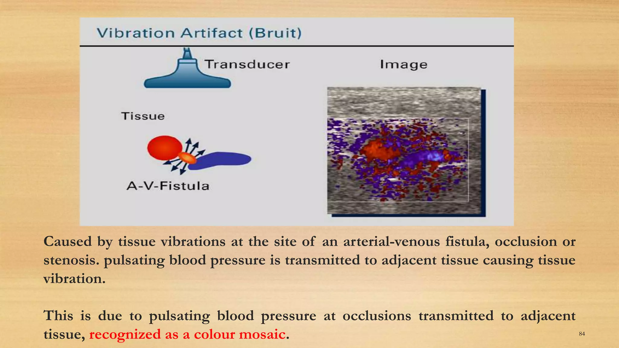 Doppler Effect - Ultrasound