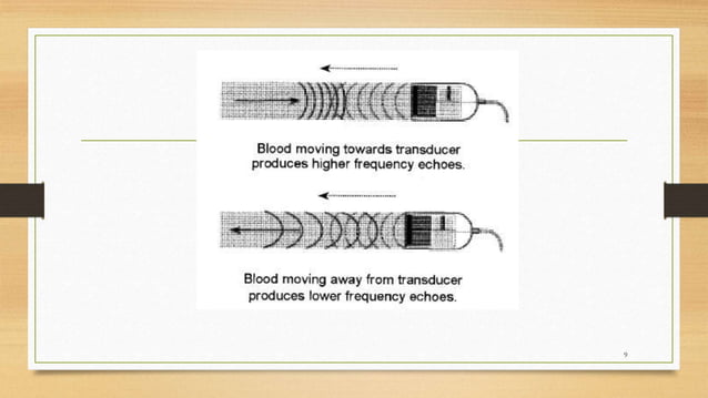 Doppler Effect - Ultrasound | PPTX | Digital Audio | Computer Software ...