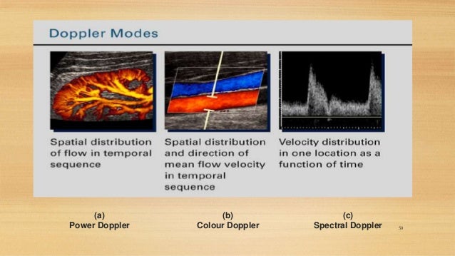 Doppler Effect - Ultrasound