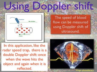 IB Physics Doppler effect flippingphysics by Nothingnerdy | KEY