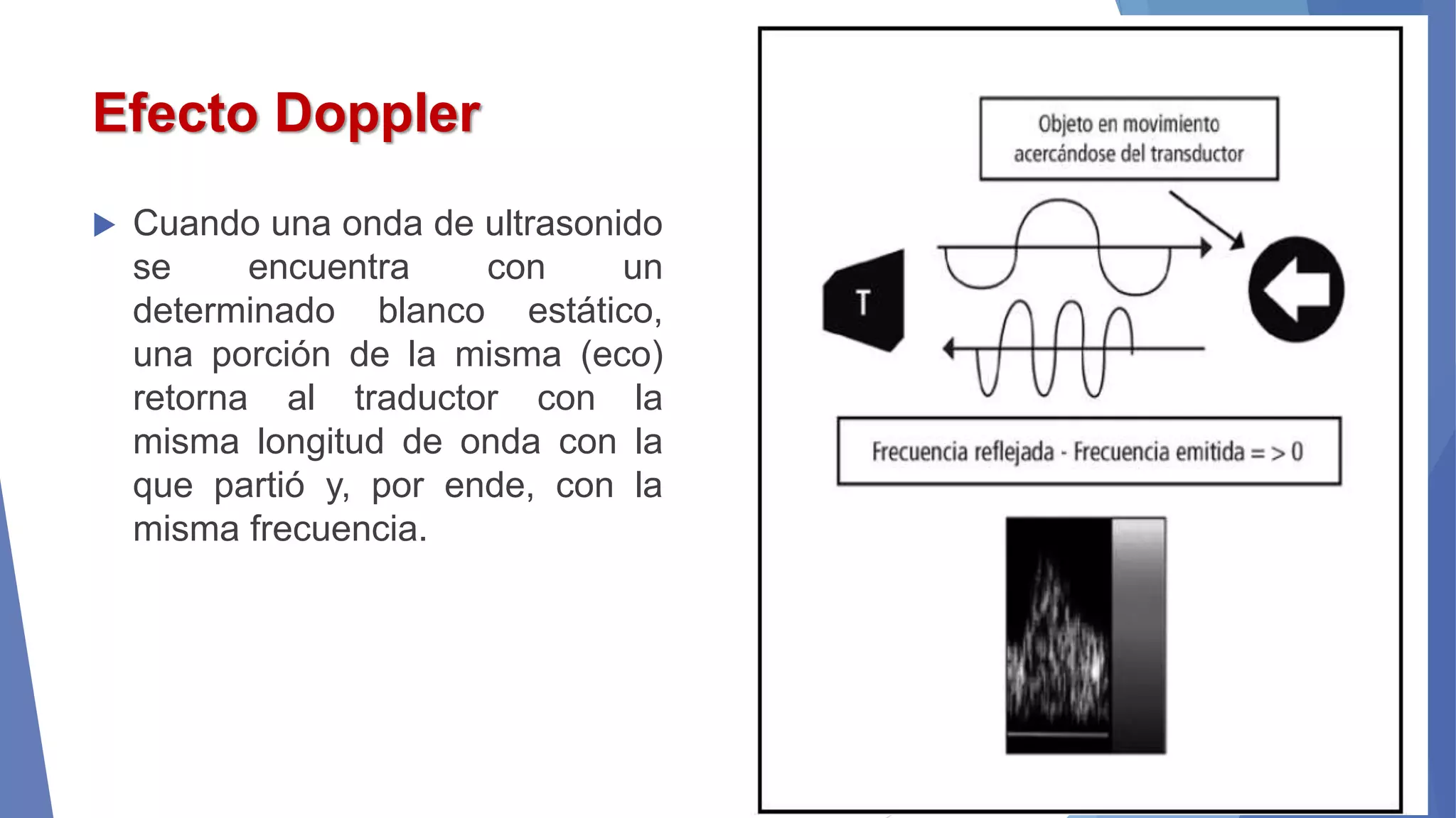 Doppler en obstetricia | PPTX