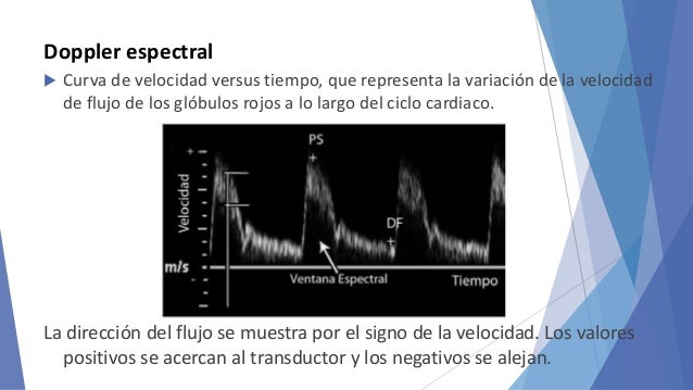 Doppler en obstetricia