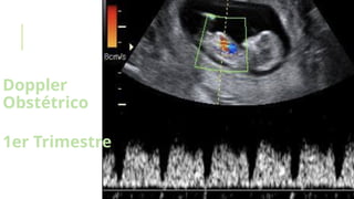 Ultrasonido obstetrico, Doppler fetal, caracteristicas | PPTX