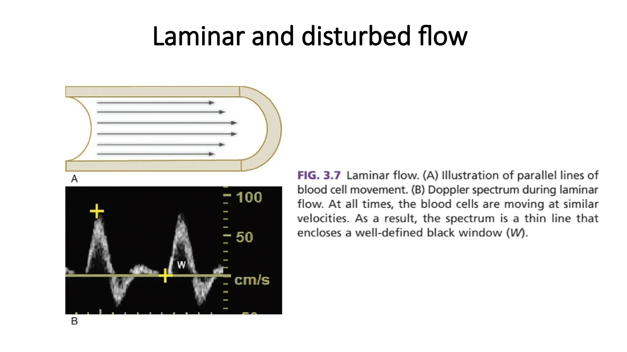 DOPPLER FLOW IMAGING AND SPECTRAL ANALYSIS.pptx