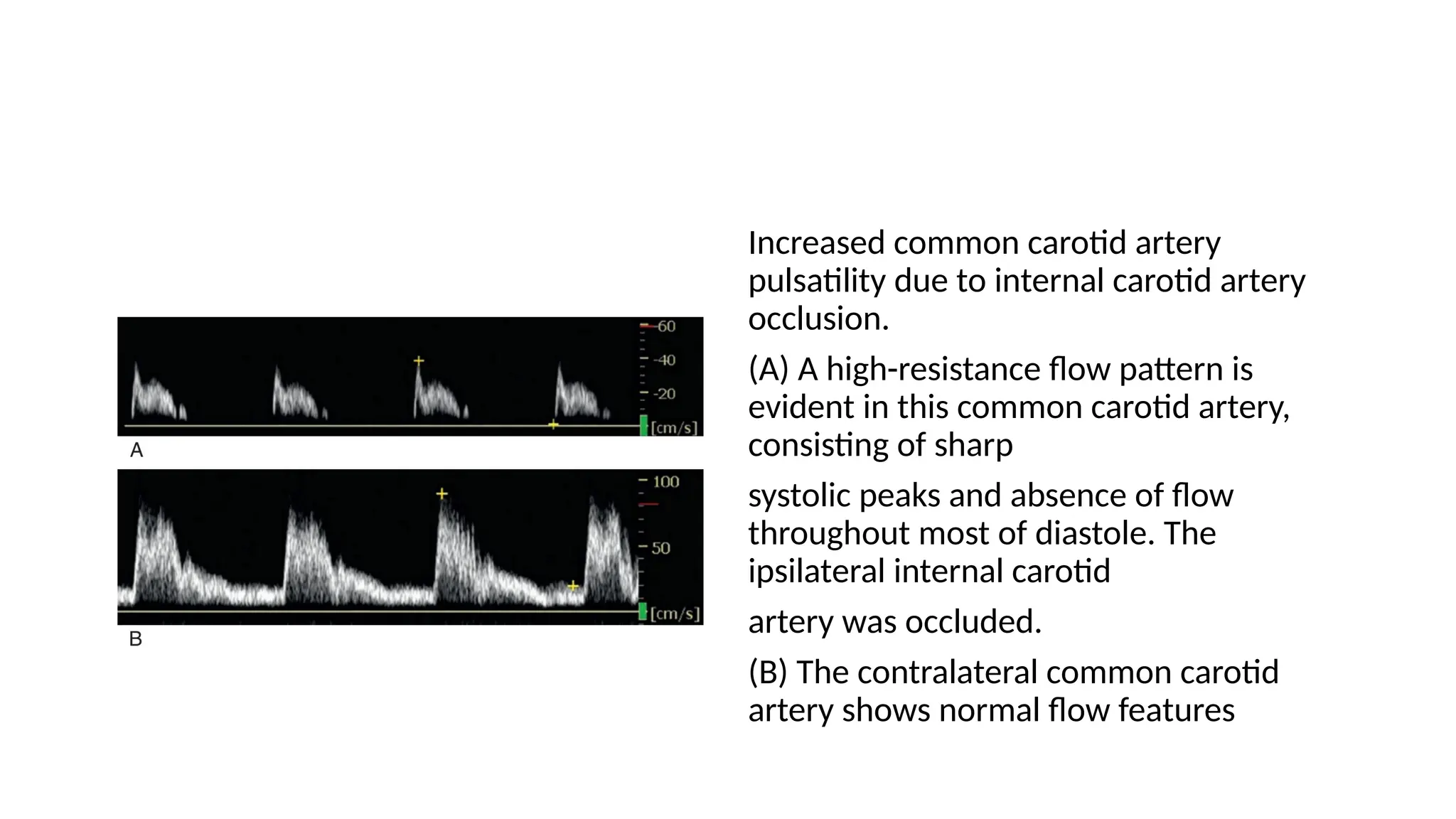 DOPPLER FLOW IMAGING AND SPECTRAL ANALYSIS.pptx