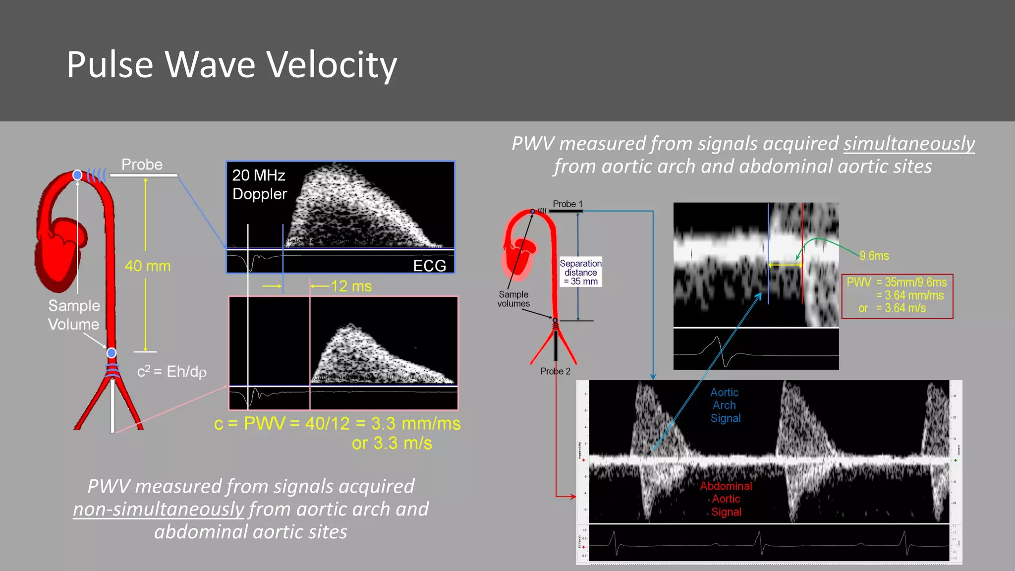 Doppler Flow Velocity Measurements for Cardiovascular Research | PDF