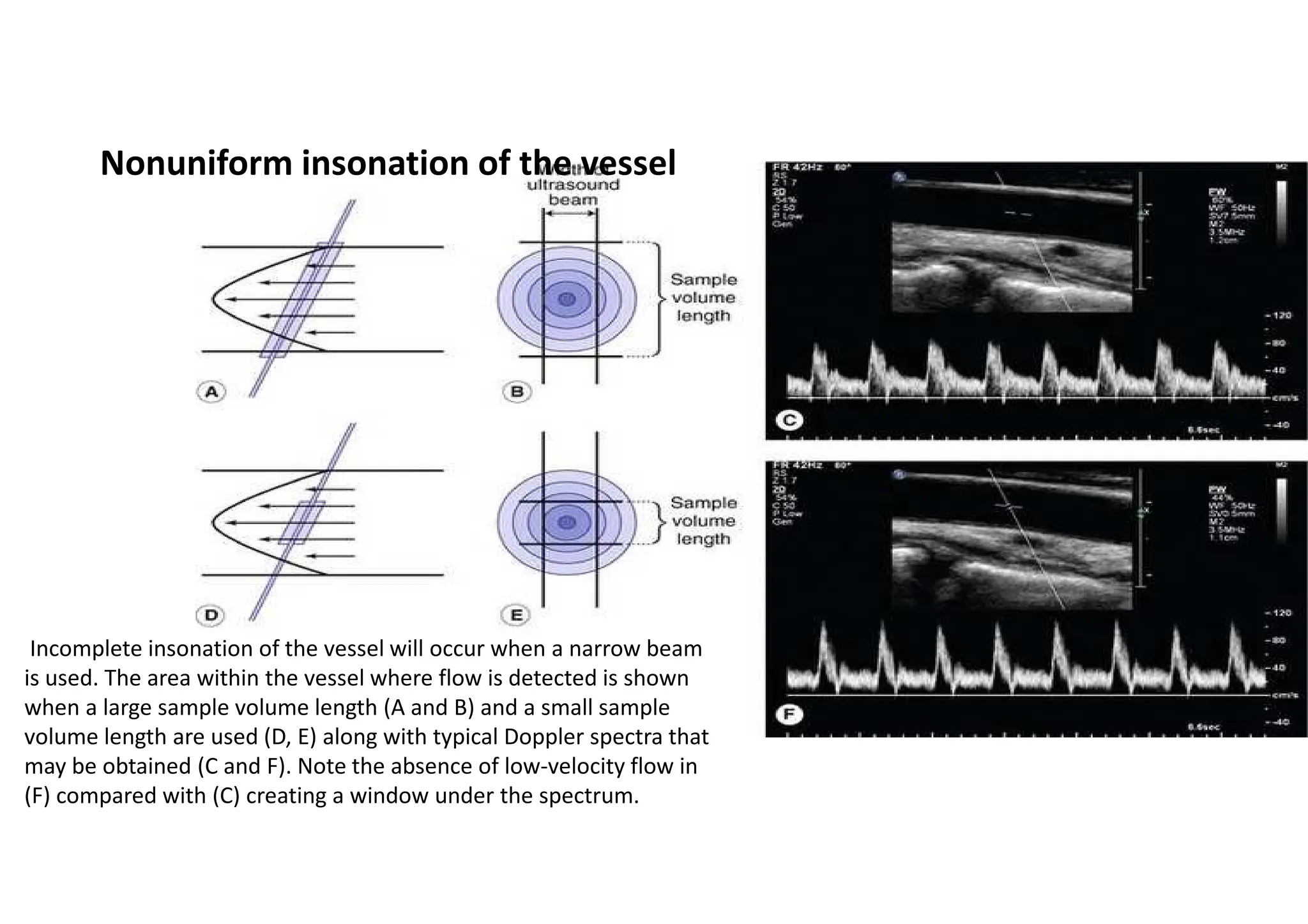 doppler gynecology pdf doppler en gynécologie | PDF