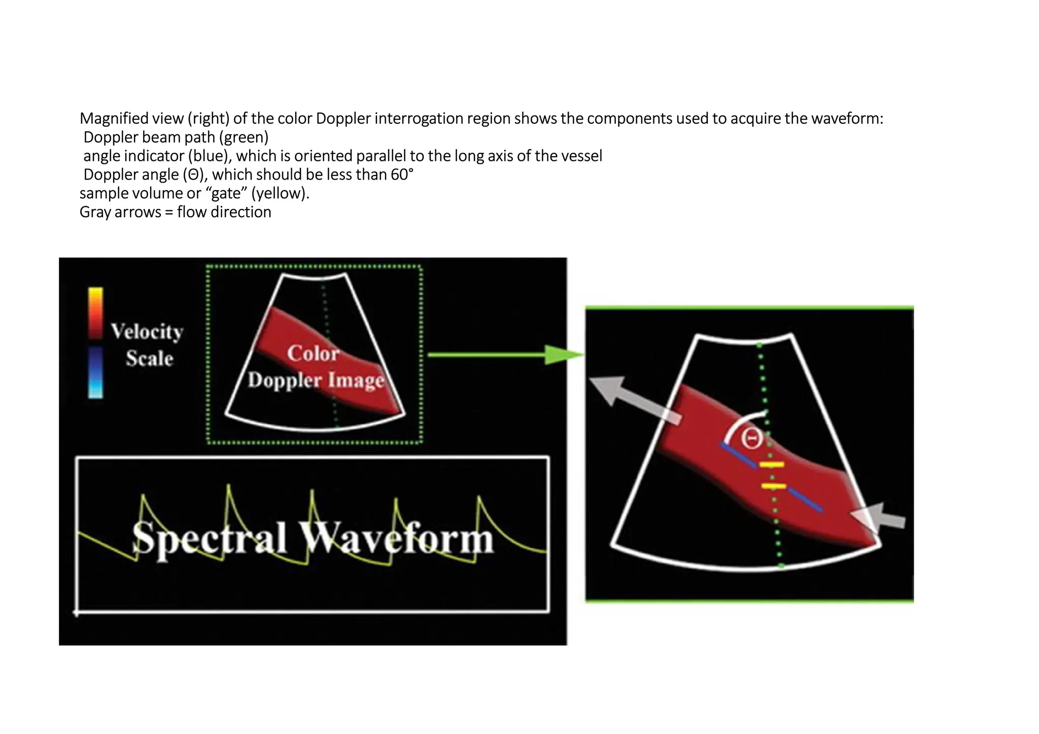 doppler gynecology pdf doppler en gynécologie | PDF