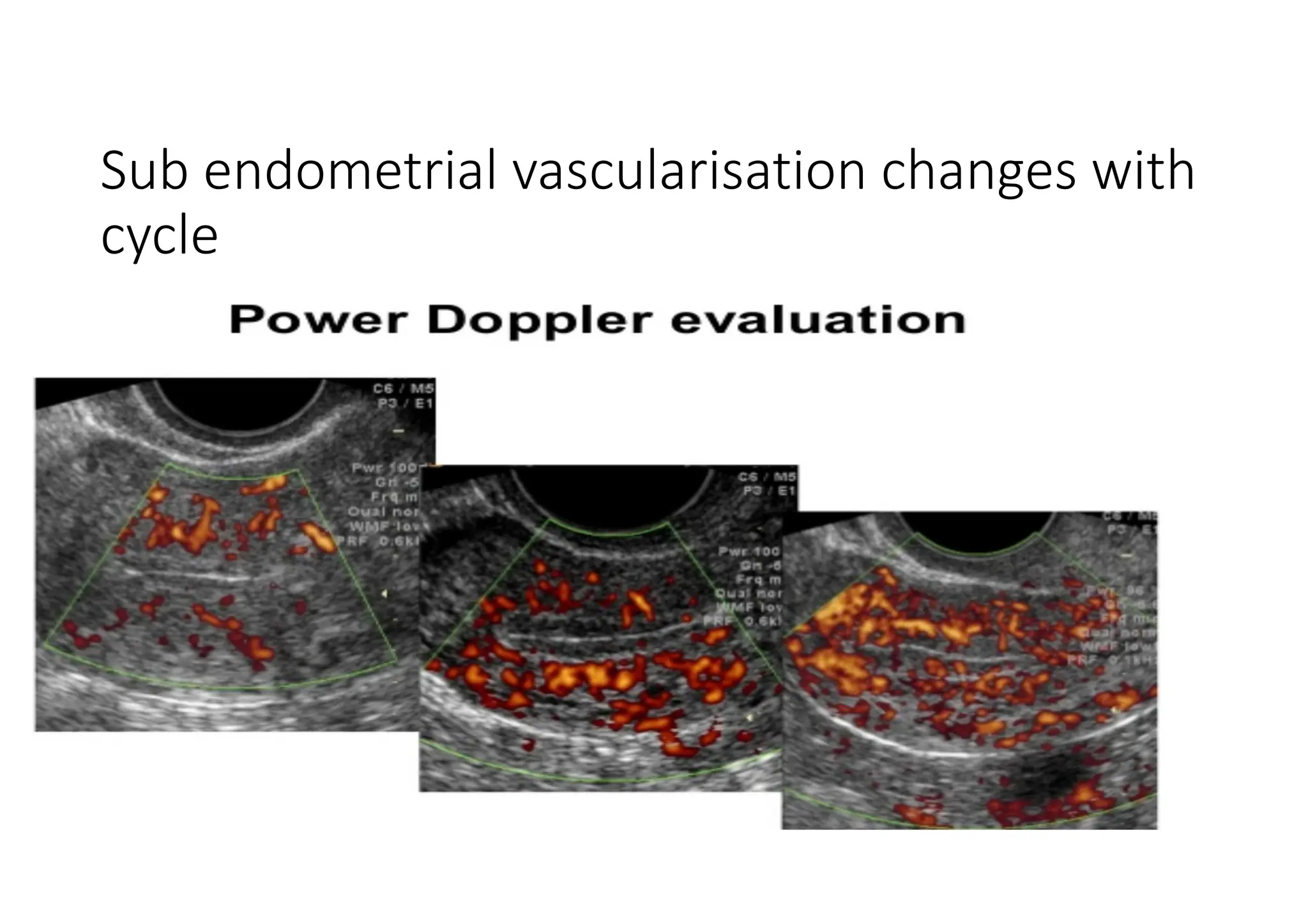 doppler gynecology pdf doppler en gynécologie | PDF