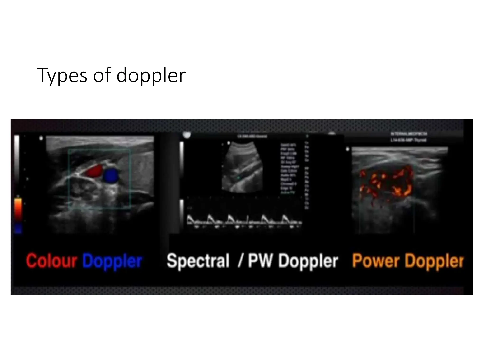 doppler gynecology pdf doppler en gynécologie | PDF