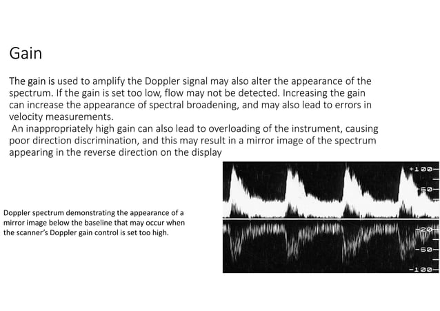doppler gynecology pdf doppler en gynécologie | PPT