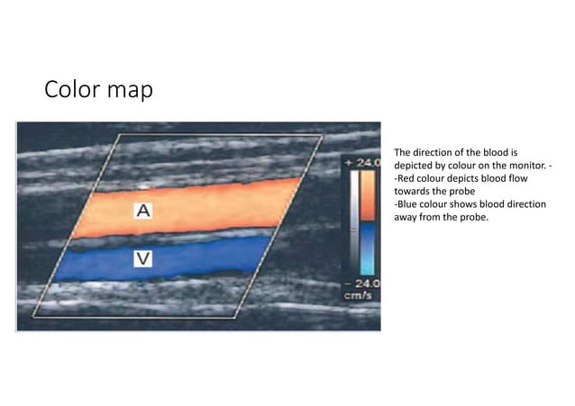 doppler gynecology pdf doppler en gynécologie | PPT