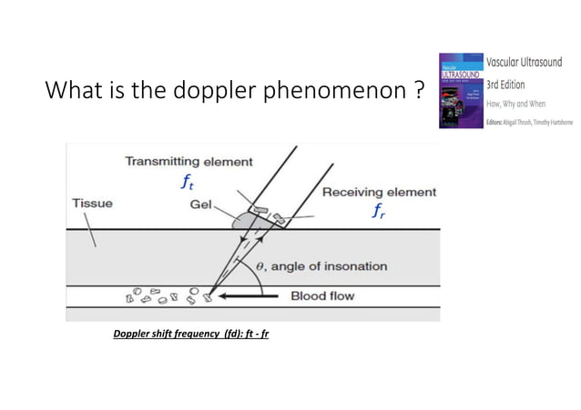 doppler gynecology pdf doppler en gynécologie | PPT