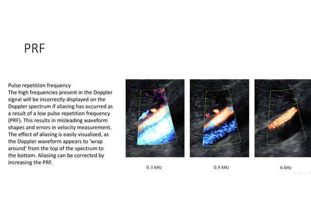 doppler gynecology pdf doppler en gynécologie | PPT