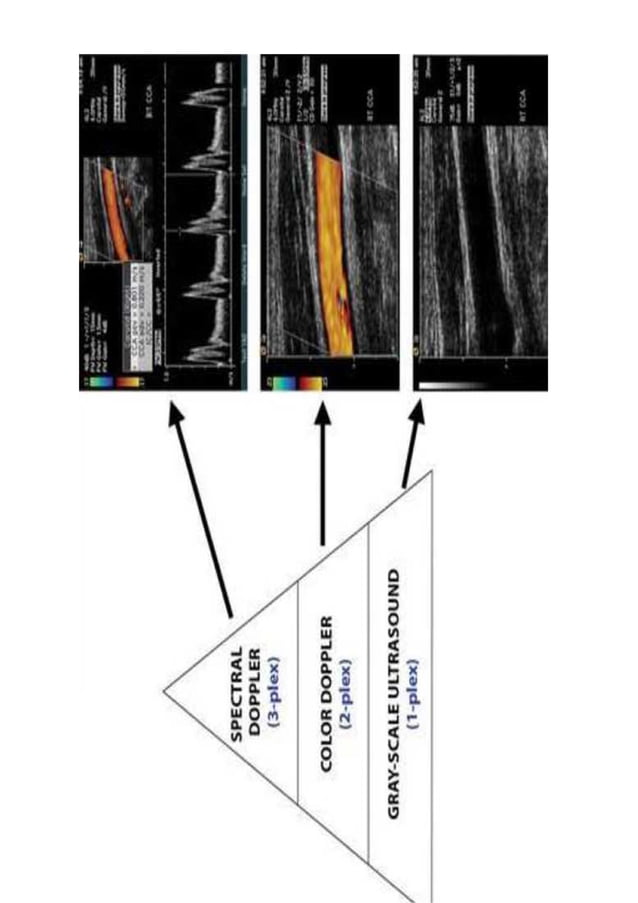 doppler gynecology pdf doppler en gynécologie | PPT