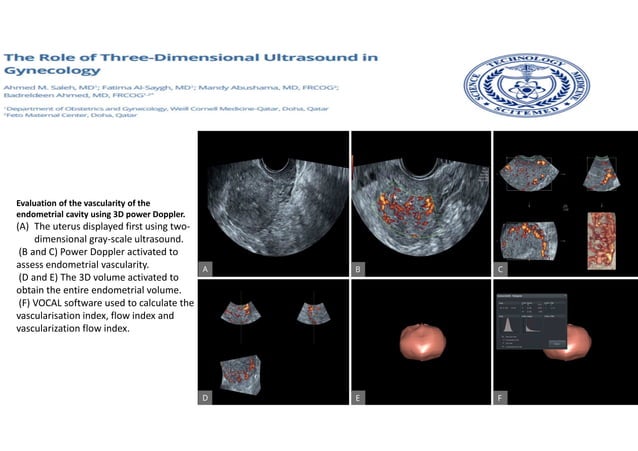 doppler gynecology pdf doppler en gynécologie | PPT