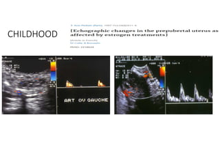 doppler gynecology pdf doppler en gynécologie | PDF