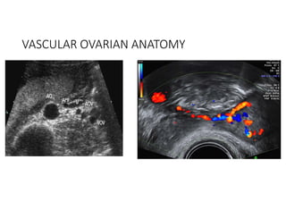 doppler gynecology pdf doppler en gynécologie | PDF