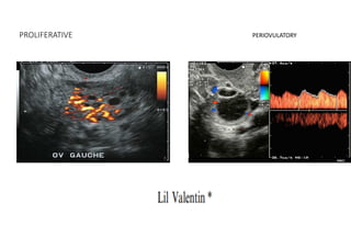 doppler gynecology pdf doppler en gynécologie | PDF