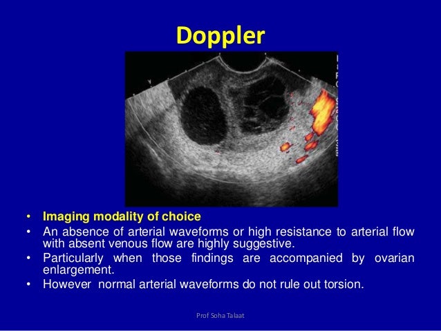 Doppler in gyneacology Dr. Muhammad Bin Zulfiqar
