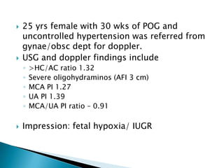 Doppler in IUGR | PPTX