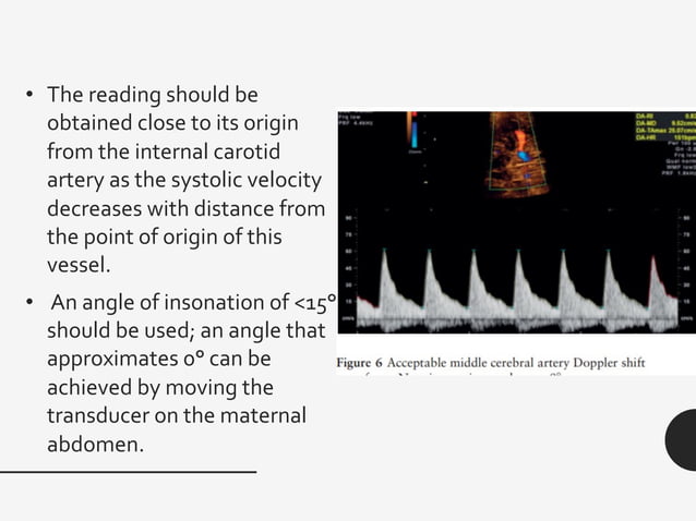 DOPPLER IN OBSTETRICS (1).pdf