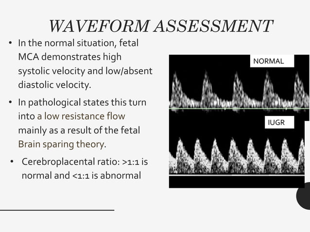 DOPPLER IN OBSTETRICS (1).pdf