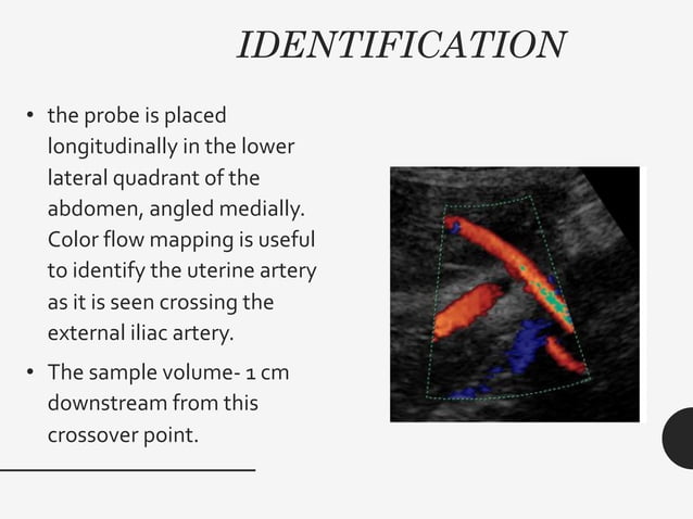 DOPPLER IN OBSTETRICS (1).pdf