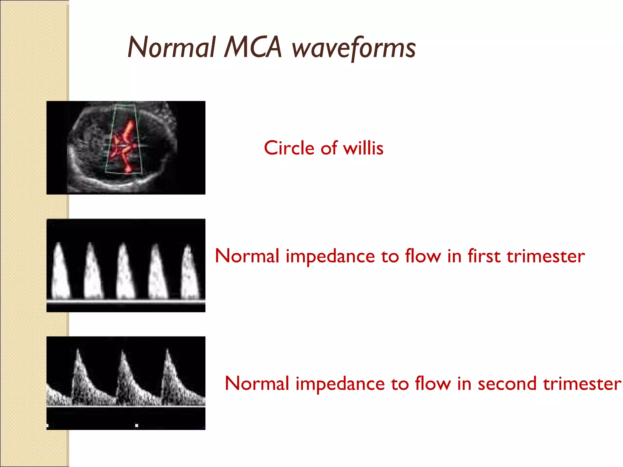 Doppler in pregnancy | PPT