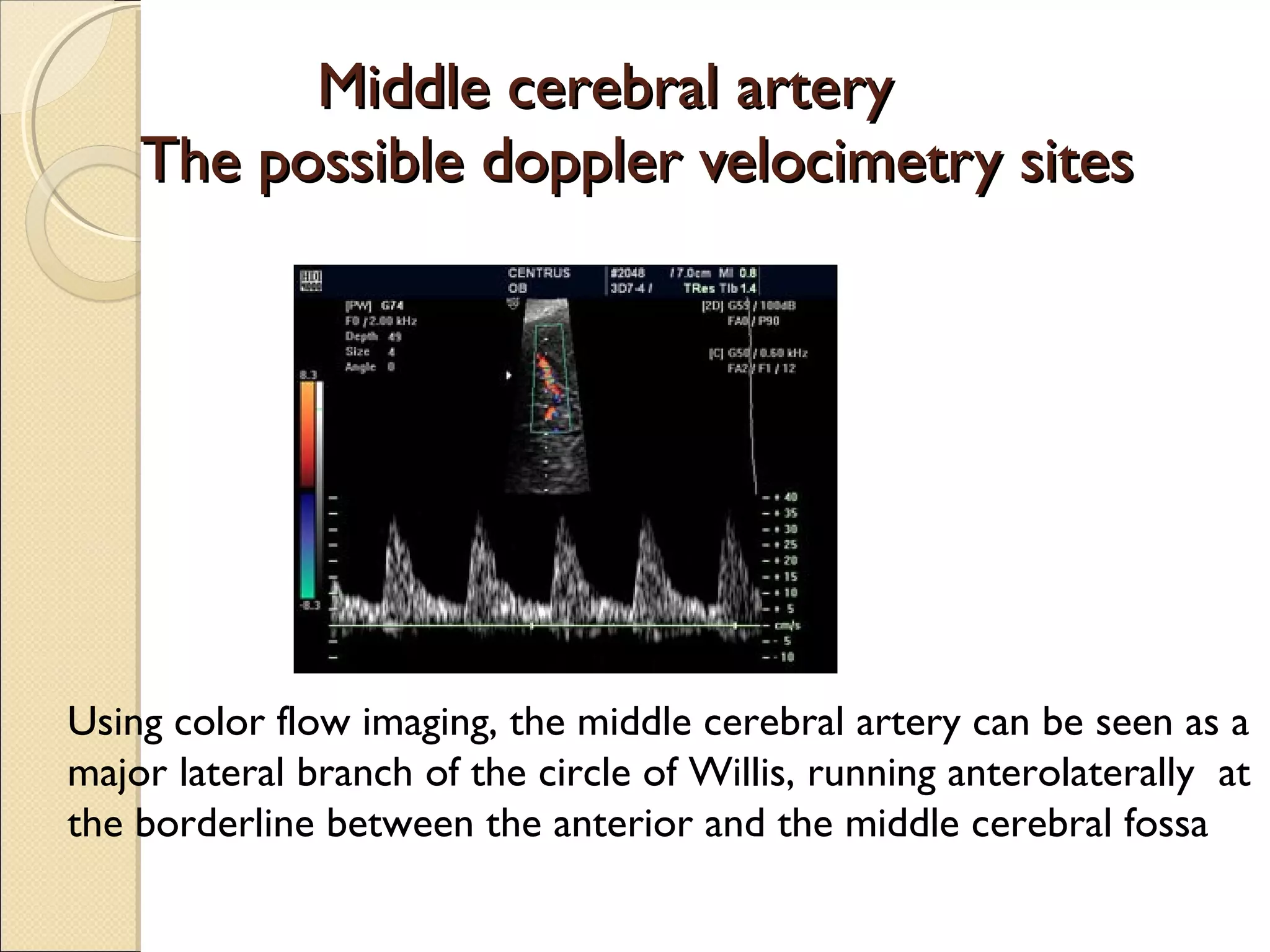 Doppler in pregnancy | PPT