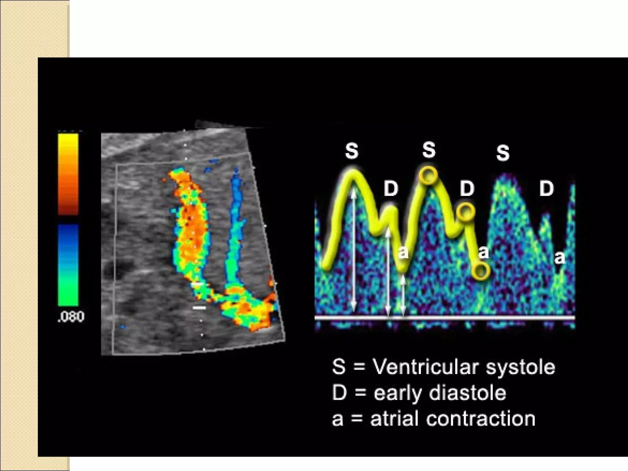 Doppler in pregnancy | PPT