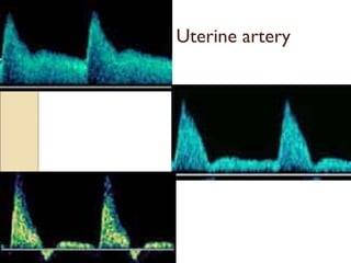 Doppler in pregnancy | PPT
