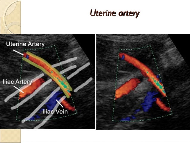 Doppler in pregnancy