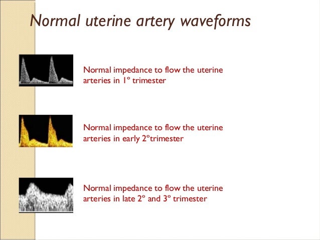 Doppler in pregnancy