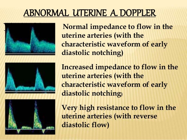 Doppler in pregnancy