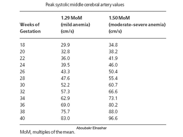 Doppler interpretation in pregnancy | PPT