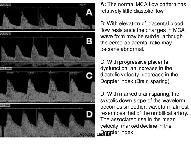 Doppler interpretation in pregnancy