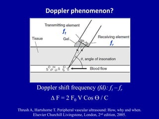 Doppler ultrasound of A-V access for hemodialysis | PPTX